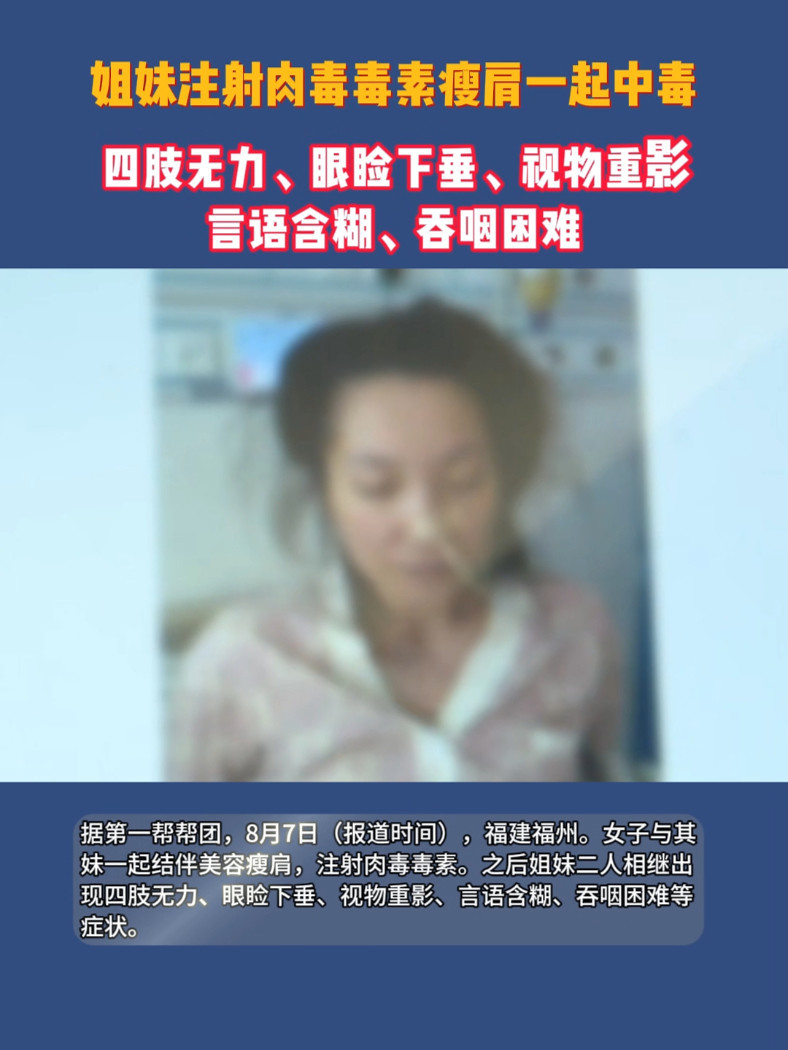 姐妹注射肉毒毒素瘦肩一起中毒