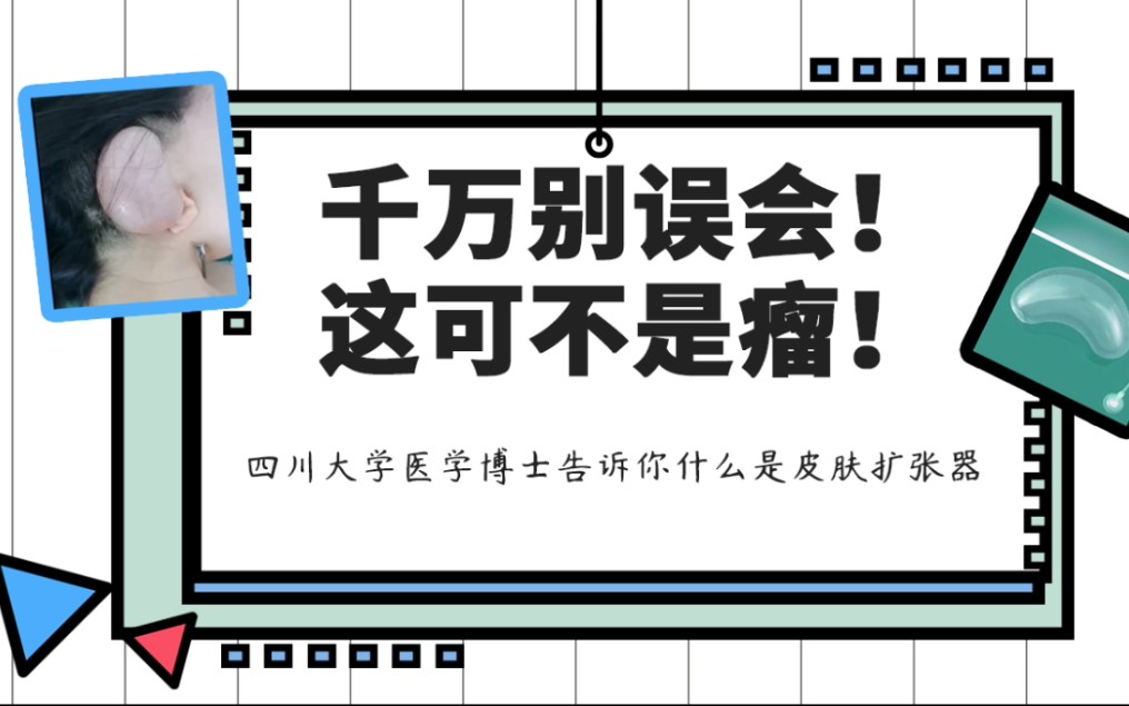 ...博士 | 老江在线解说神奇扩张器!赶紧的,看看一期真实刺激手术过程。