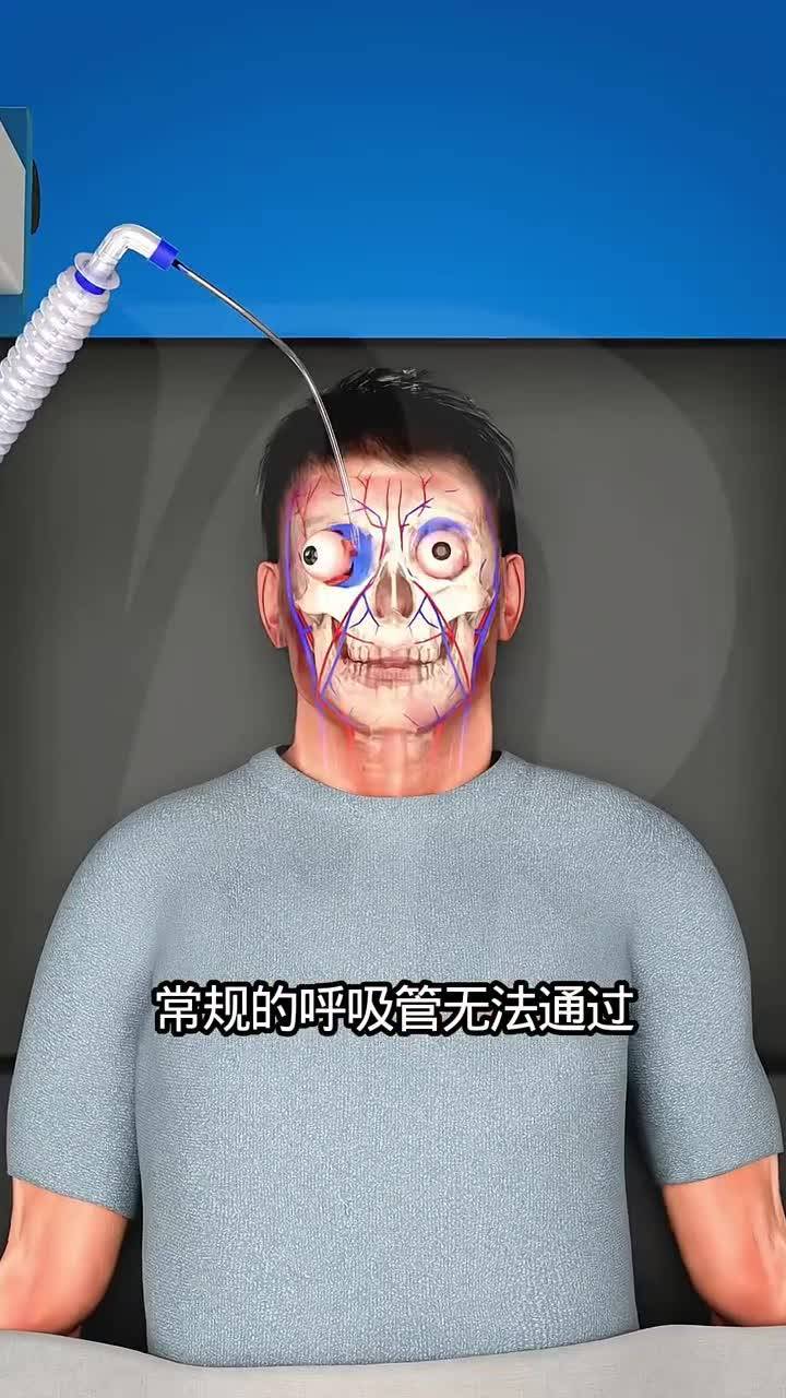 面部受伤怎么通过呼吸管呼吸?