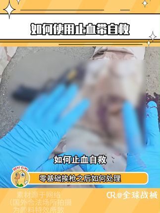 #自救 #技巧 #求生 #止血带 希望大家永远用不到这个!@DOU+小助手
