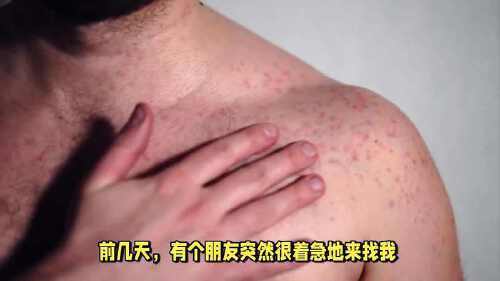 皮肤老化竟会引发"红痣"?樱桃血管瘤真相揭秘!