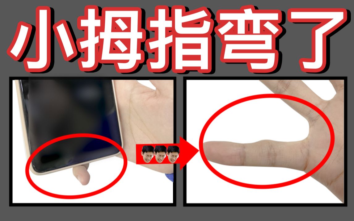 玩玩玩手机,小拇指会永久畸形?!