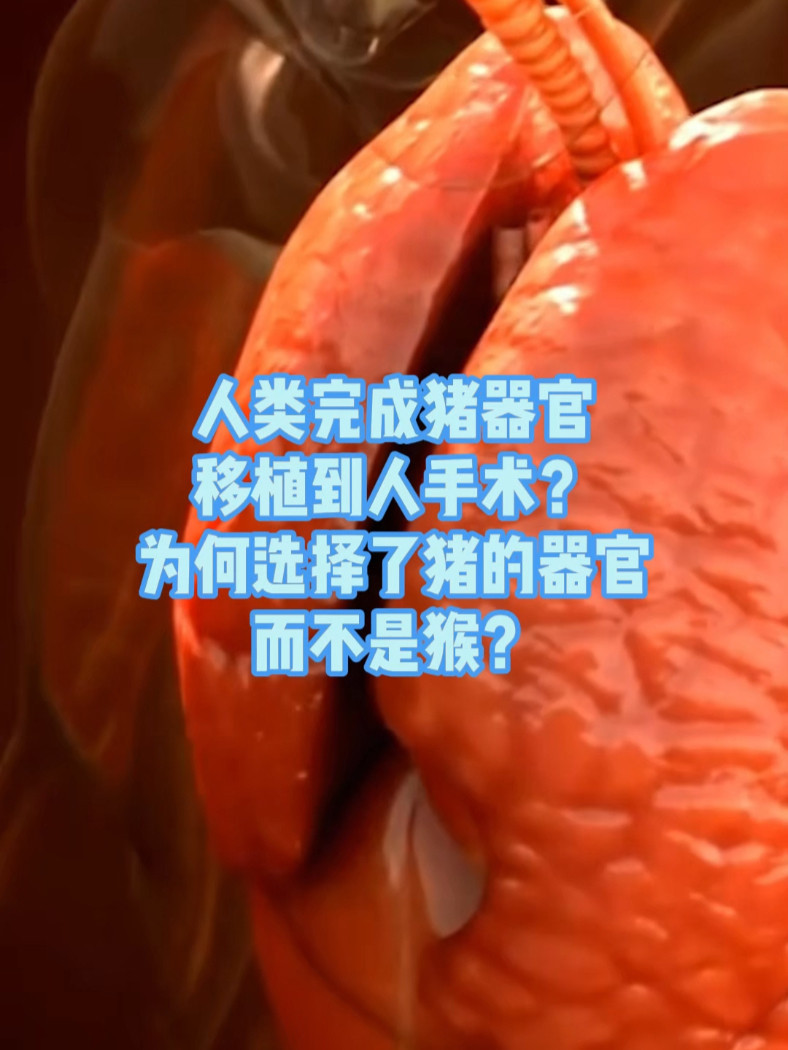 人类完成猪器官移植到人手术?为何选择了猪的器官而不是猴?