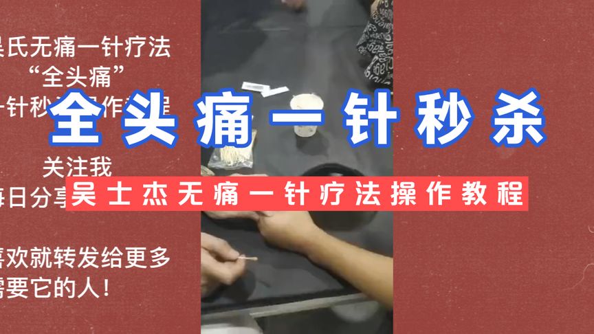 吴士杰无痛一针疗法——“全头痛”针灸操作教程