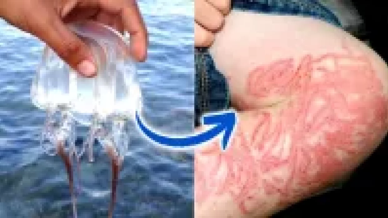 世界上5种最毒的海洋生物!