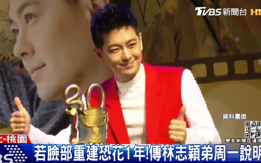 林志颖脸部重建估花一年!受伤肿脸照遭网疯传,家人称「不会生气,想...