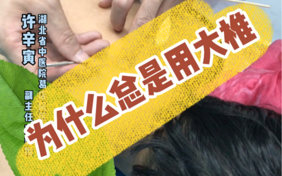 为什么总是用大椎穴?