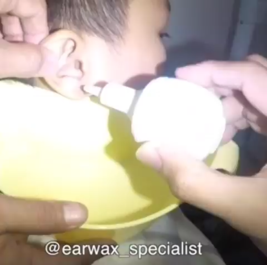 洗耳球原来是这么用的