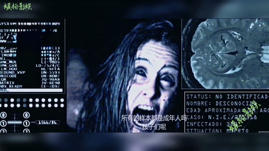 感染病毒大脑直接导致细菌污染感染2