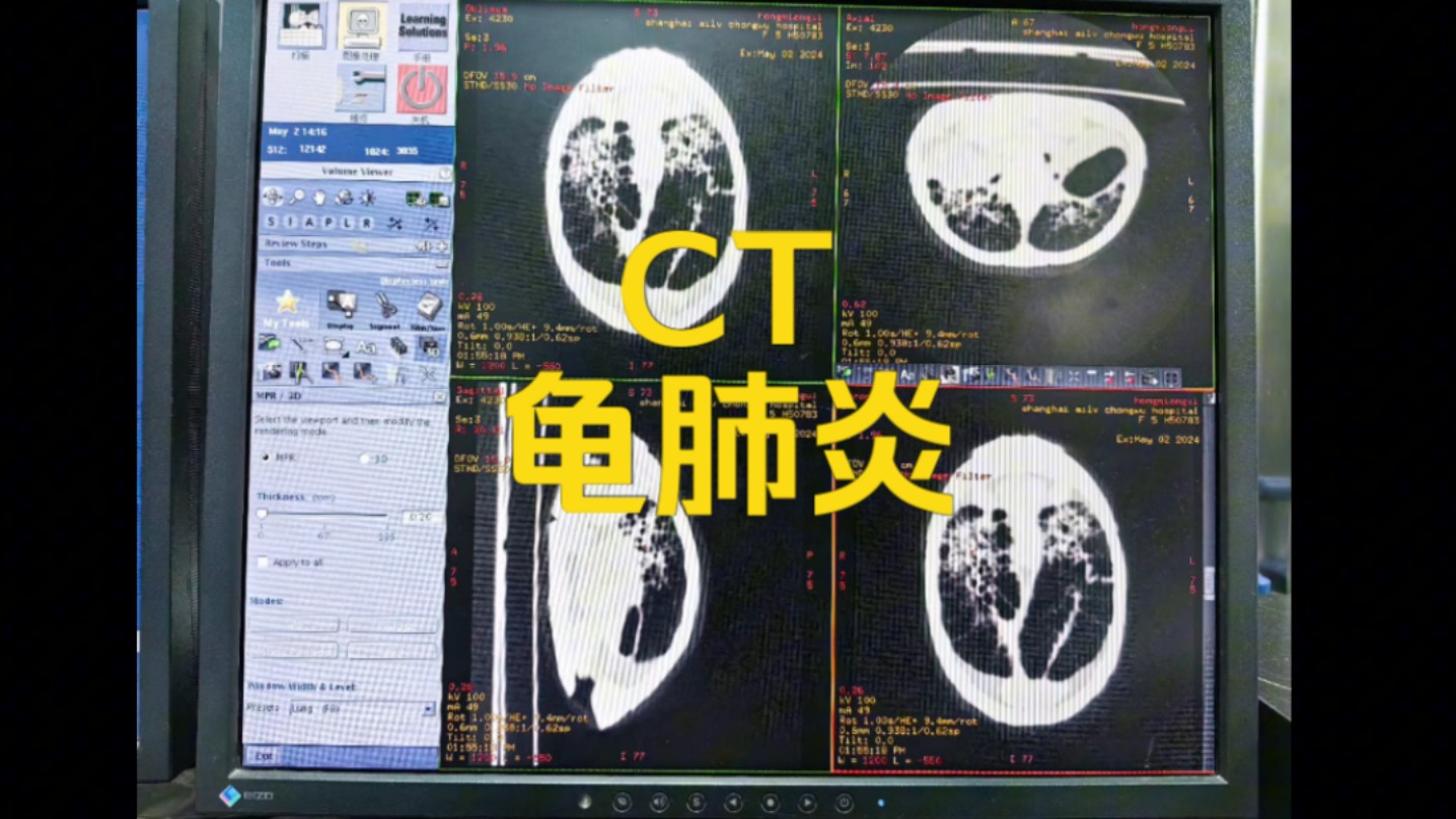如何用CT帮龟检查肺炎。