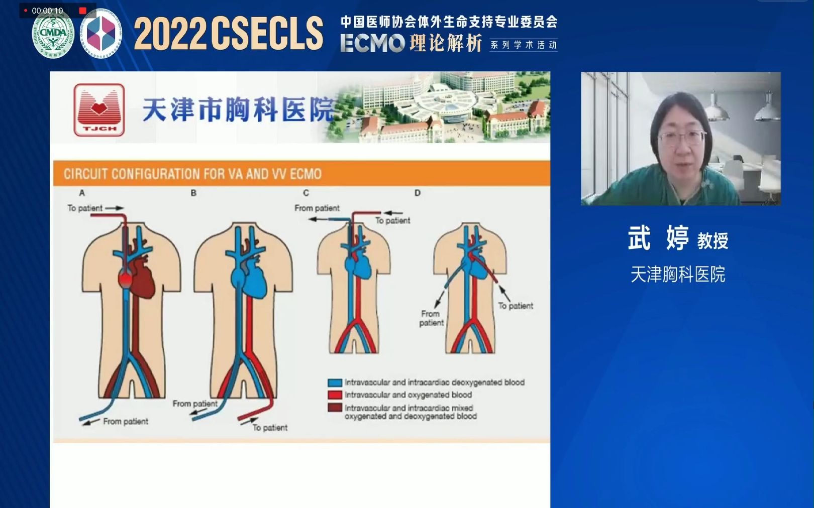 ECMO插管与位置