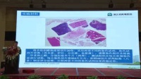 9. 两套HE 染色试剂在Leica 全自动HE 染色机中的应用比较--王明伟