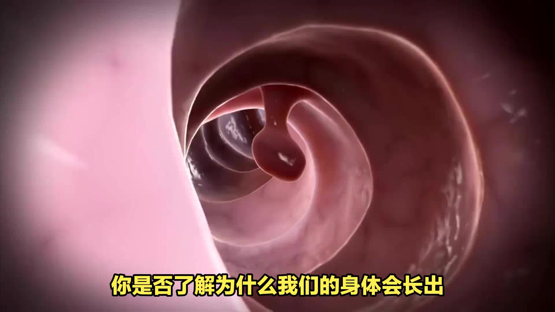 为什么我们身体会长出痔疮这种东西?