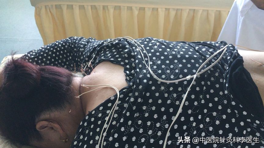 颈肩腰腿痛的针灸、艾灸治疗。