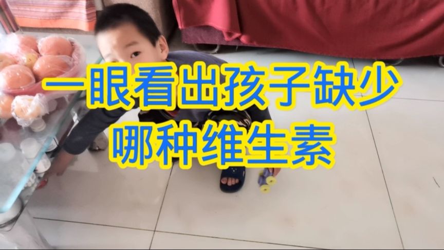 通过这些症状,一眼看出孩子缺少哪些维生素