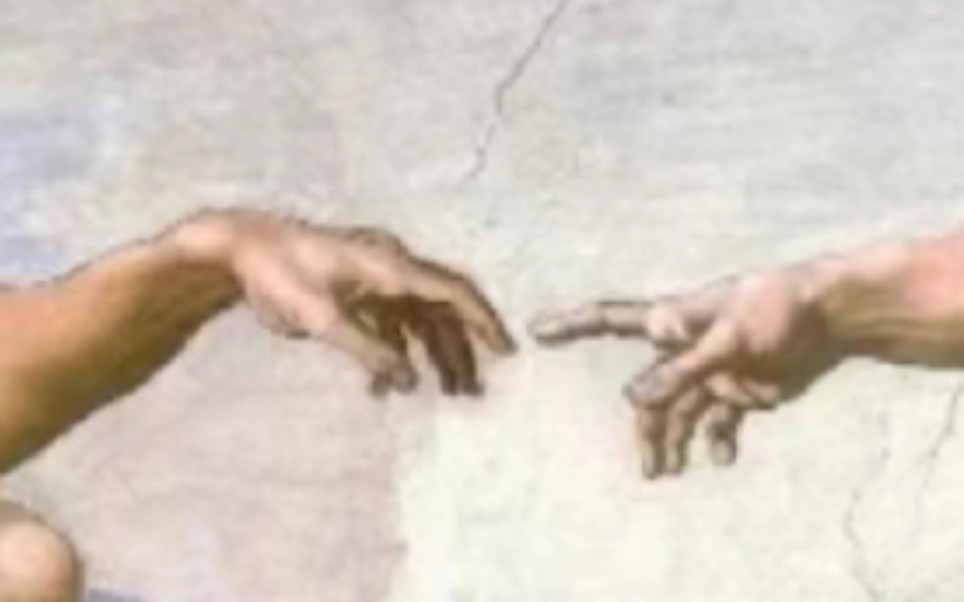 逆行导丝与顺行导管“触碰”,成功开通闭塞血管,挽救缺血的下肢