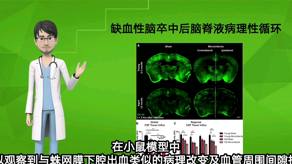 脑脊液循环的新发现(四)