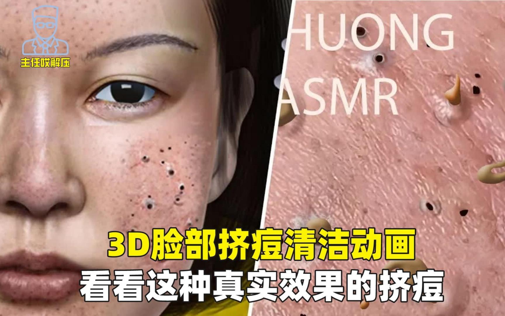 解压动画,3D脸部挤痘清洁动画,看看这种真实效果的挤痘痘