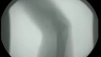 钙与生命(钙的重要作用)