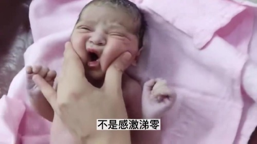 宝宝刚出生竟成这样,当宝爸把另一边脸也转过来,彻底怒了