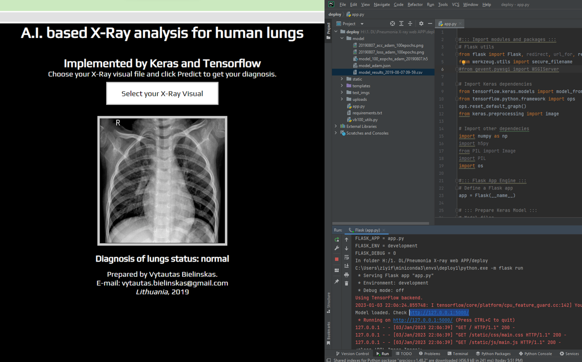 [医学AI-网页APP]读X-Ray图像预测肺炎类型 Python,Flask框架