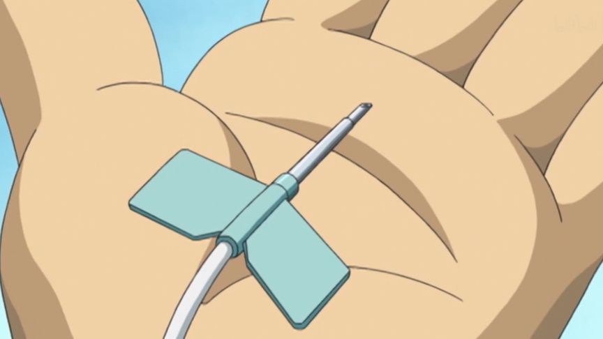 注射针头断在病人动脉之中,医生准备手术取出,却突然消失