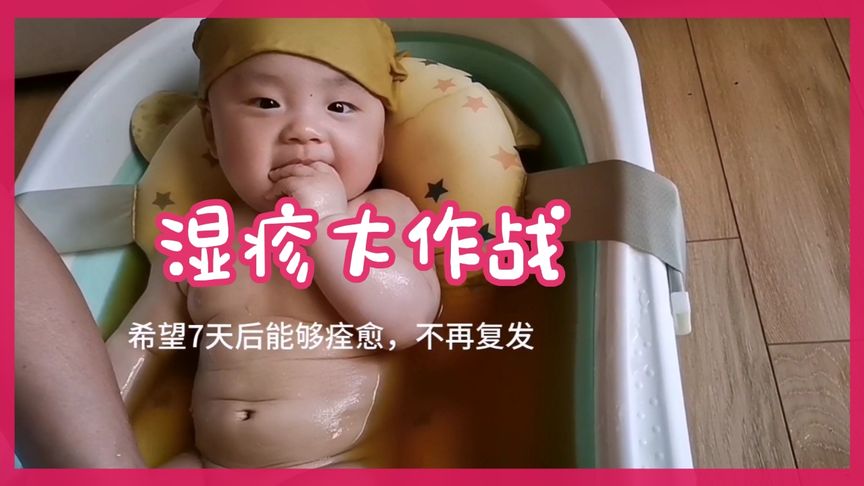 湿疹宝宝中药泡澡中