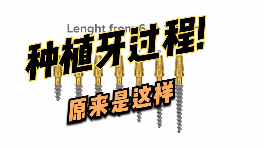 种植牙过程,原来这么多门道!