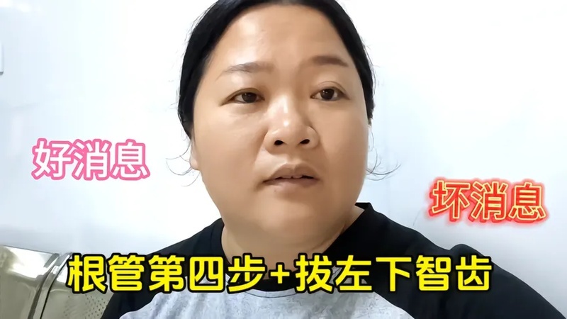 根管治疗完的好消息与坏消息,又胜利拔下一颗智齿,花了多少钱