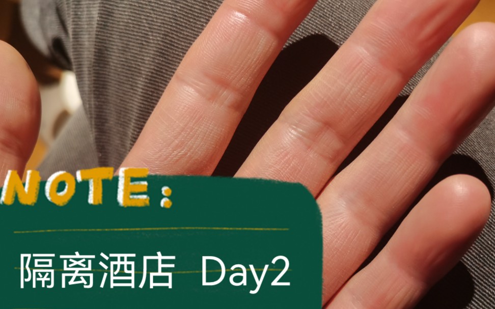 小伙在上海做志愿者 手被消毒液腐蚀 隔离酒店志愿者第二天 只求能...