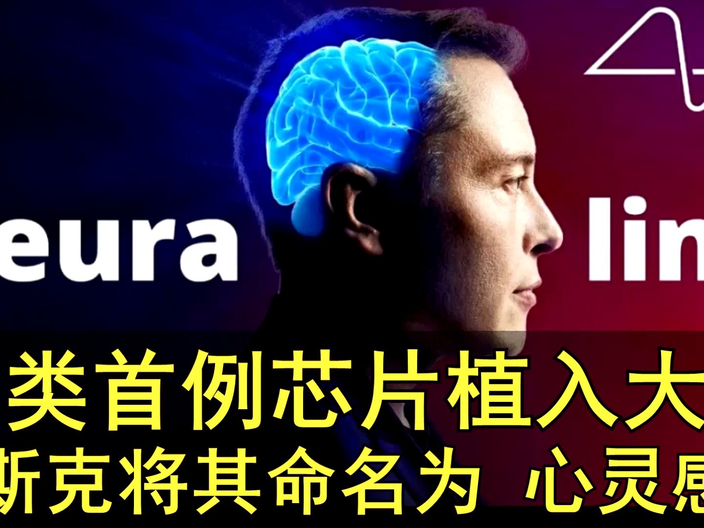 马斯克:已完成人类首例脑机接口手术,首款产品名为Telepathy“心灵...