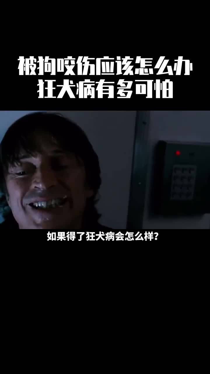 你知道狂犬病有多可怕吗?