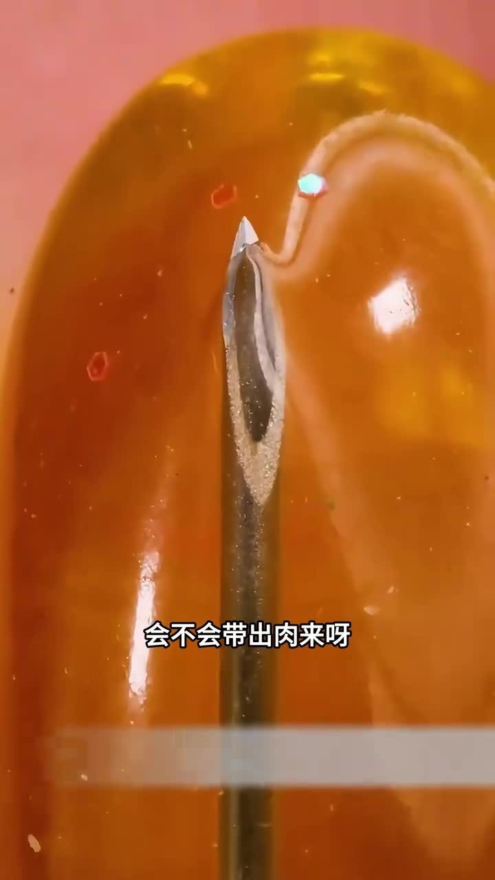 打针时,注射器会带出肉来吗?解压科普微观世界注射器打针