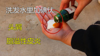 洗头时,在洗发水里加一点碘伏厉害了,解决了困扰多年的难题