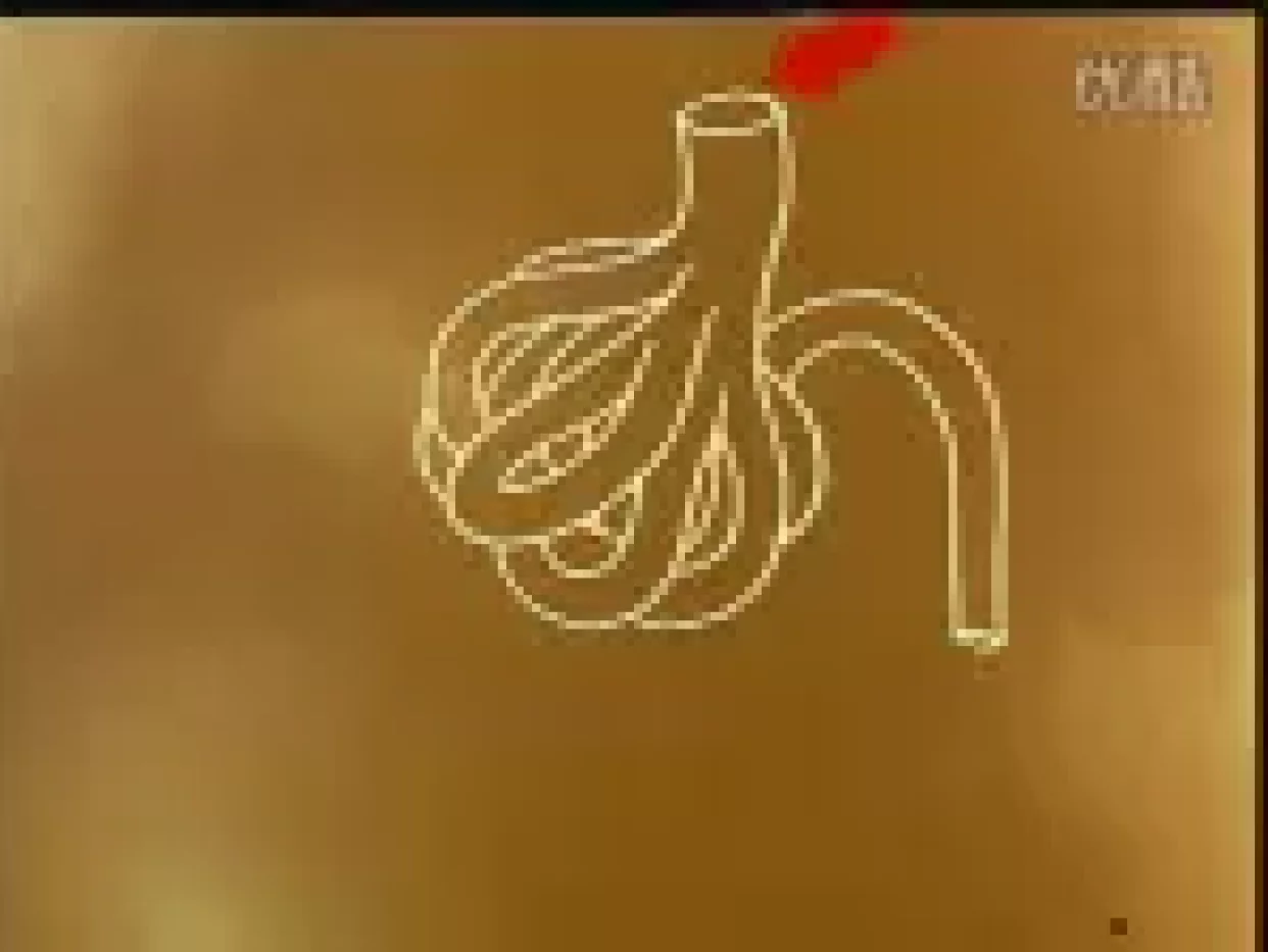 泌尿系统的组成及尿液的产生和排出_标清