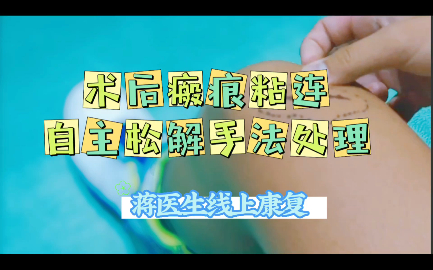 术后瘢痕粘连de自主松解手法处理