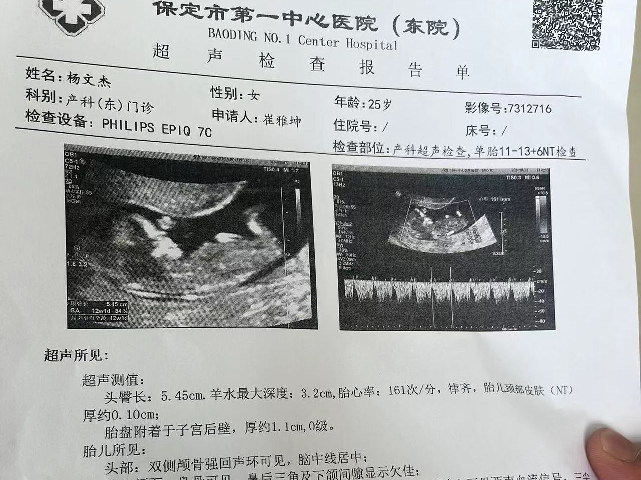 怀孕12周第一次检查,看看都需要做什么?