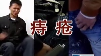 痔疮的最佳治疗方法