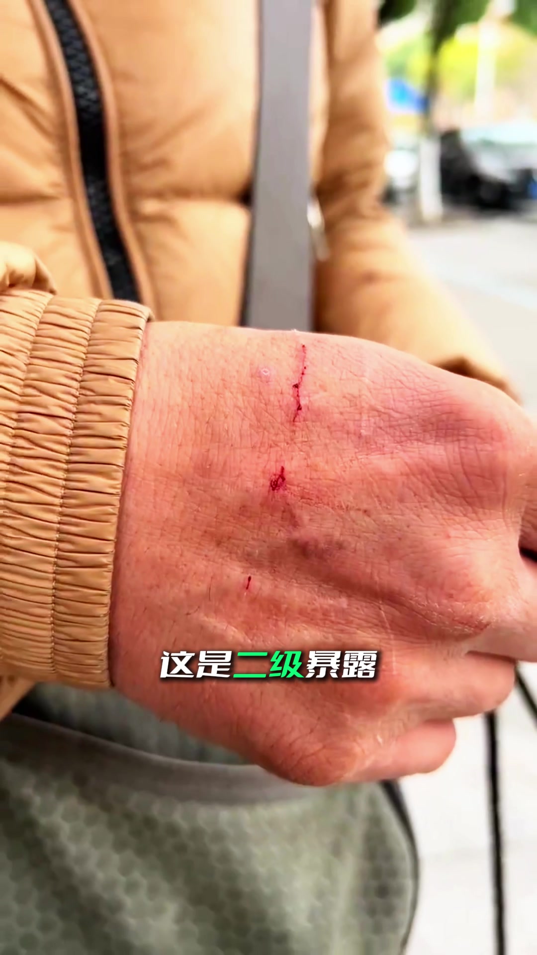 ...狂犬病检测卡,遇到问题省心快速处理#科学养宠攻略 #狂犬病 #被狗咬...