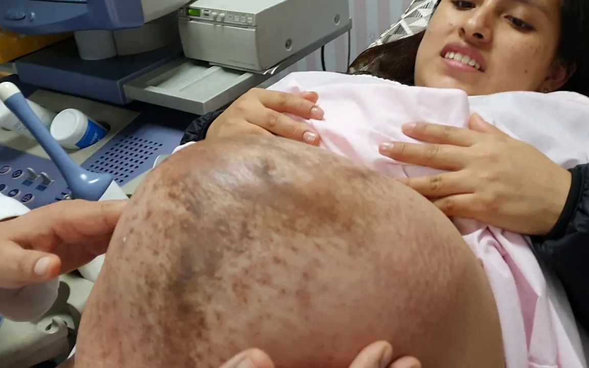 隔着一层薄薄的肚皮看胎动,生命太神奇了!