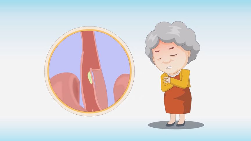 急慢性支气管炎患者病情发作时如何缓解症状?听听医生的建议