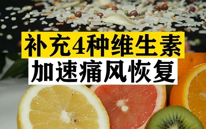 补充4种维生素,加速痛风恢复