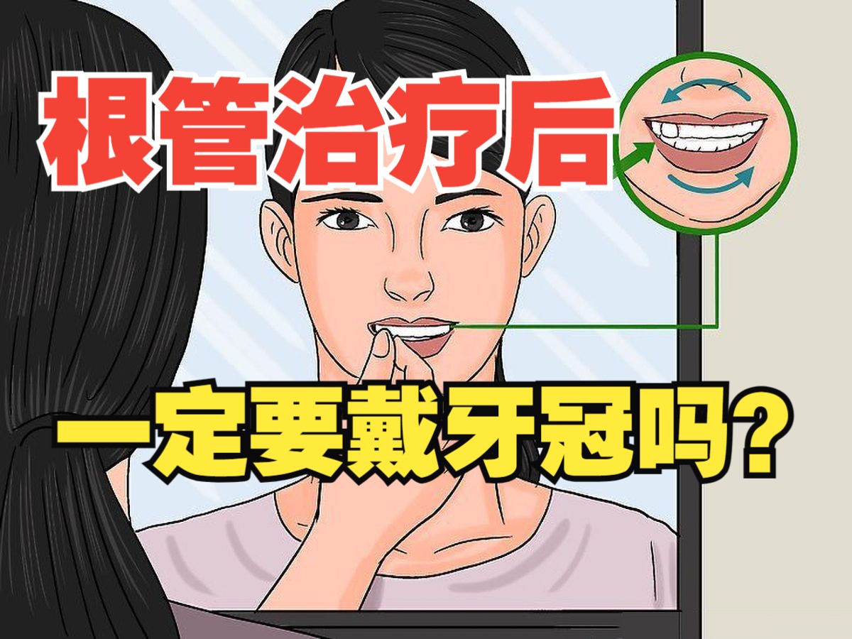 根管治疗后一定要戴牙冠吗?戴与不戴有哪些影响?看看你是哪种情况?...