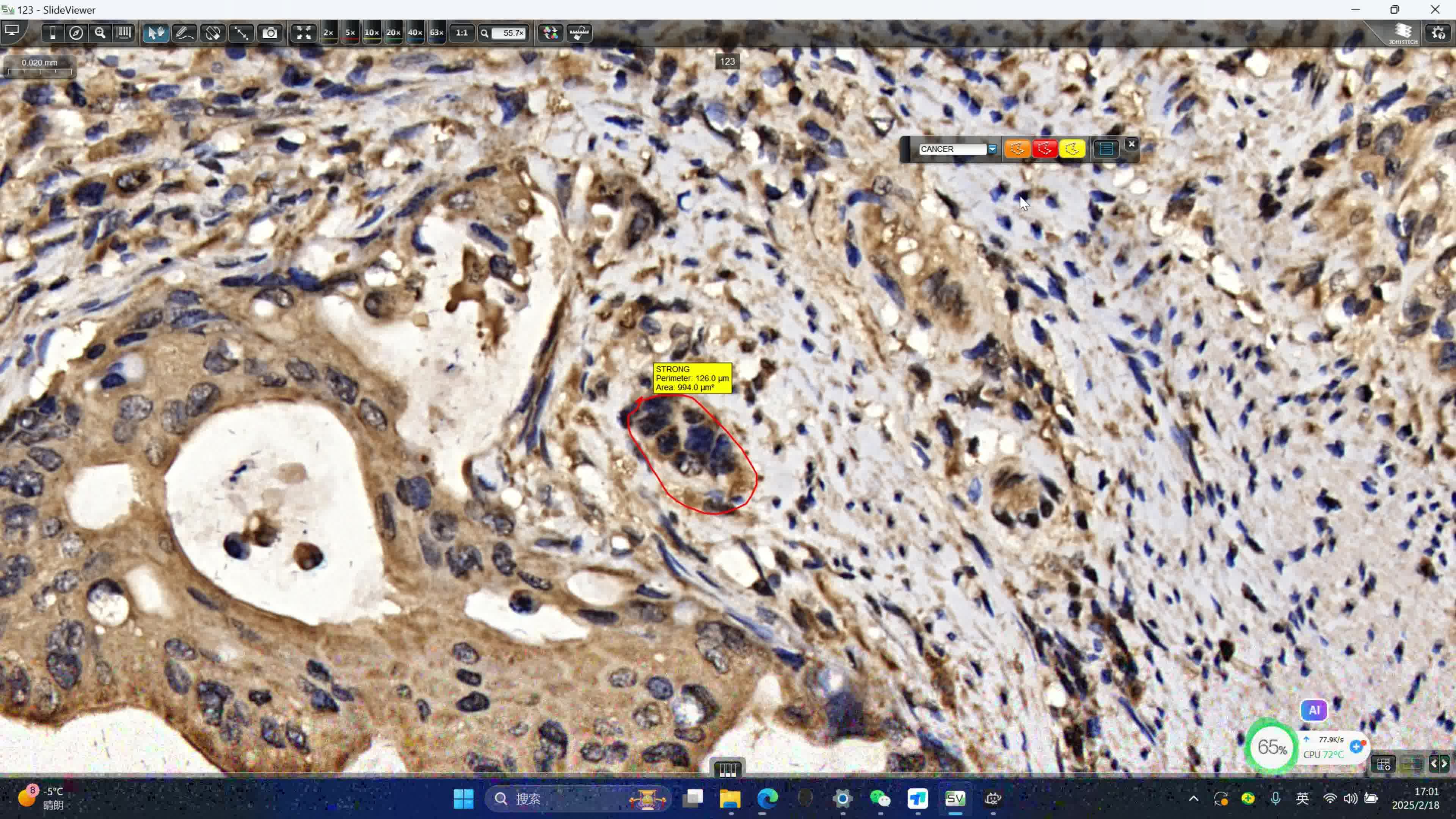 slideviewer 软件对免疫组化图片标记