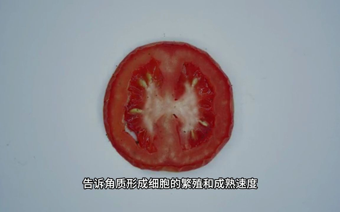 牛皮癣是怎么形成的
