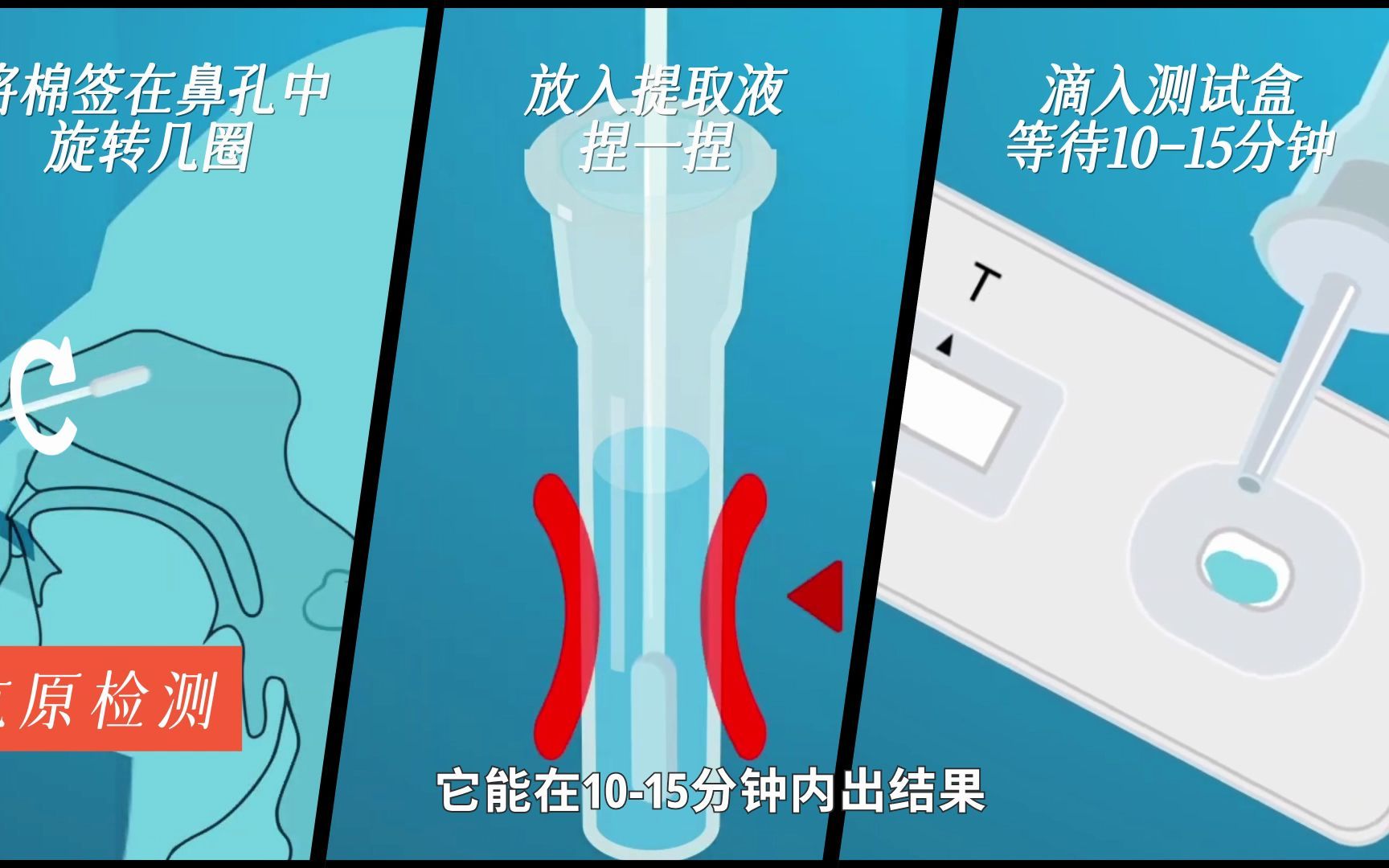 新冠病毒的抗原检测