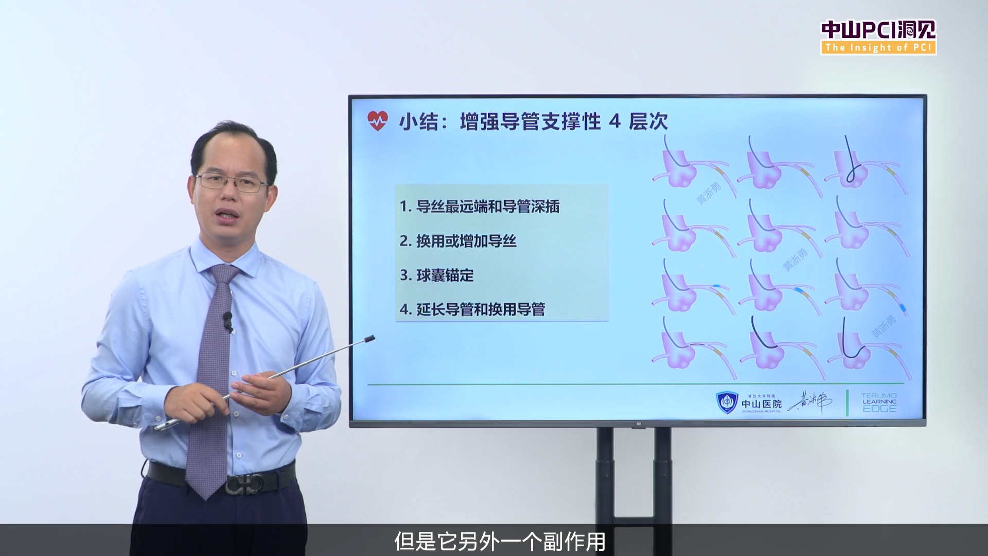 中山PCI洞见|83. 如何增强指引导管支撑力?