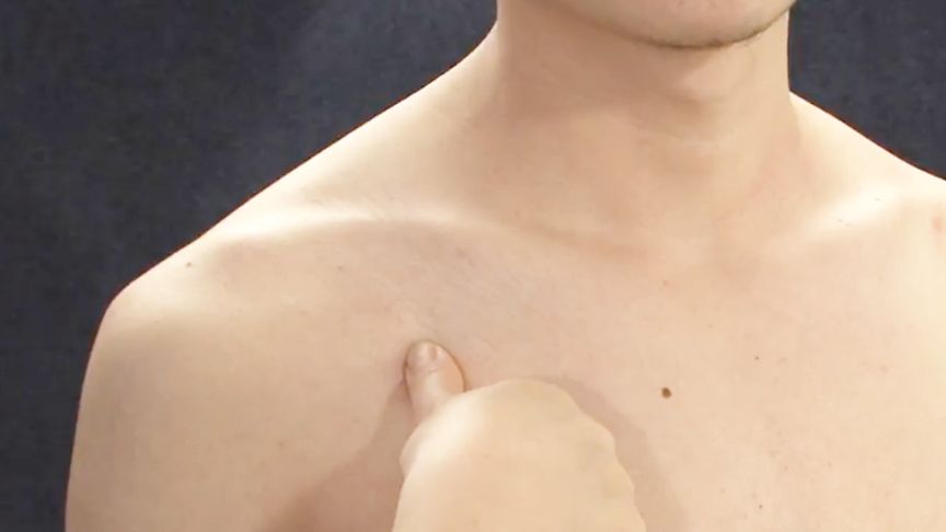 包治百咳的妙法——按揉中府穴