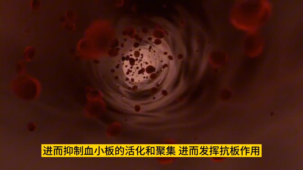 脑梗死患者常用的4种抗血小板药物,优缺点一文讲清