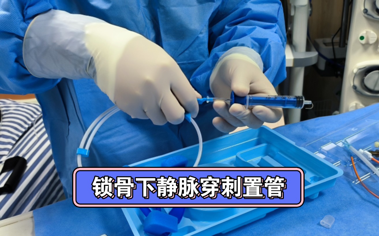 锁骨下静脉穿刺置管